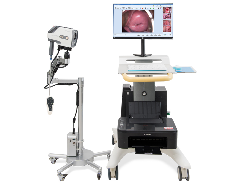 Full HD Digital Video Colposcope in Portable Digital Colposcope Supplier