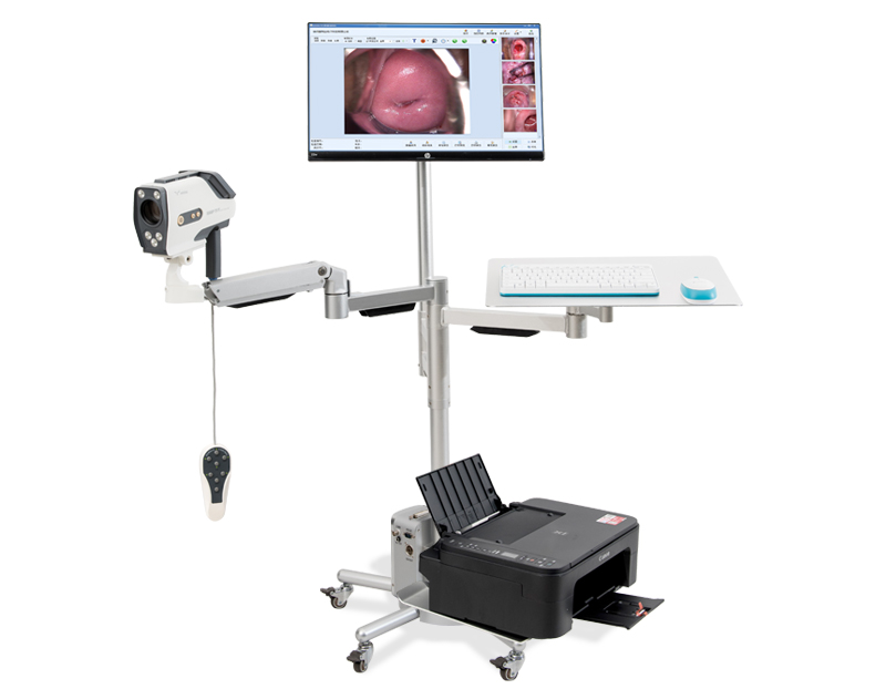 Digital Colposcope and Portable Digital Colposcope in Full HD Medical ...