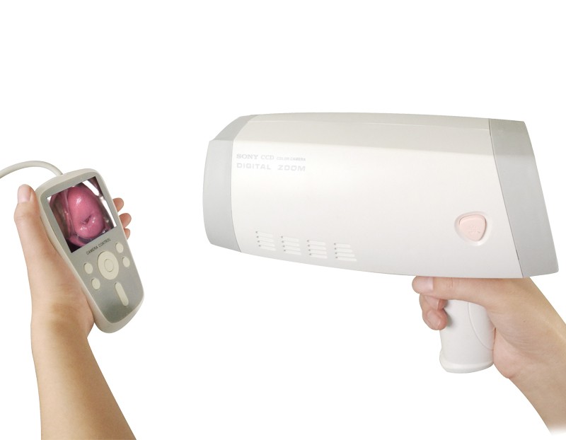 Full HD Digital Video Colposcope in Portable Digital Colposcope Supplier
